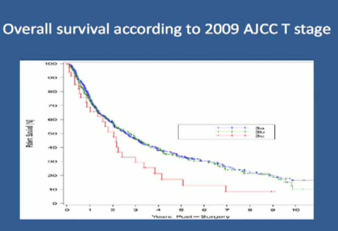 Locally Advanced RCC/ Kidney Cancer; Dr. Chris Wood; TumorThrombi ...